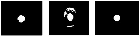 binary images after thresholding download scientific diagram