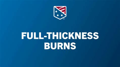 What Is A Full Thickness Burn Burn And Reconstructive Centers Of America