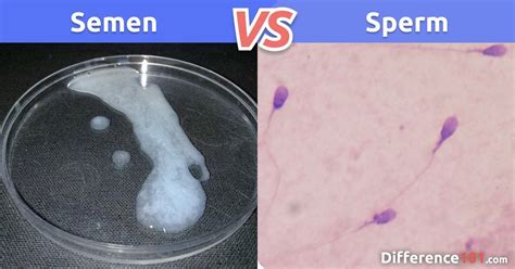 Difference On Tumblr Semen Vs Sperm What Is The Difference Between Semen And Sperm Semen