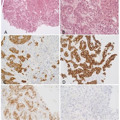 Representative Histological And Immunostaining Of Intrahepatic