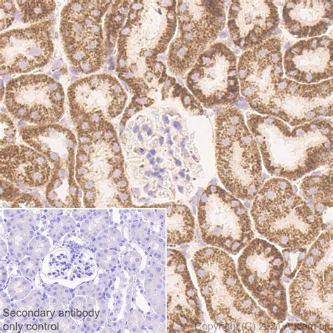 Recombinant Anti Tomm20 Antibody [epr15581 39] Mouse Igg1 Chimeric