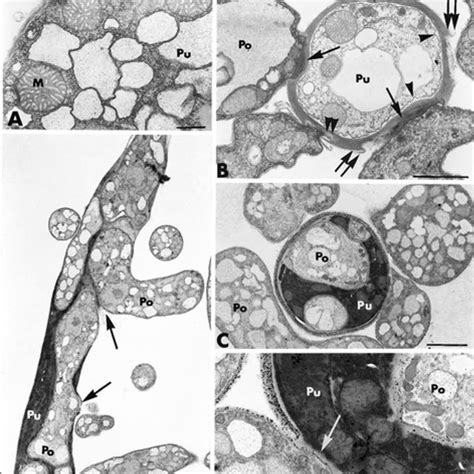 Scanning Electron Micrographs Of Pythium Oligandrum Hyphae Interacting Download Scientific
