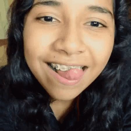 Braces  Braces Discover And Share S