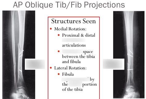 Rtca 141 Week 2 Tib Fib Knee Distal Femur Ap Oblique Tib Fib Diagram Quizlet