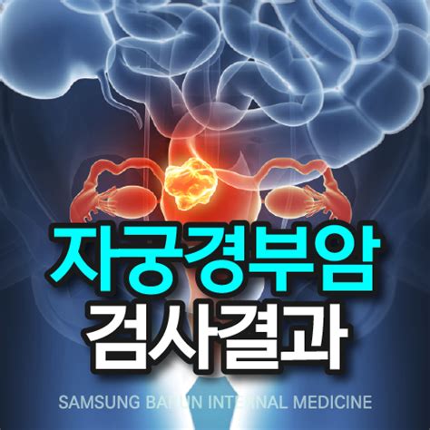 자궁경부암 검사결과 반응성세포변화란 네이버 블로그