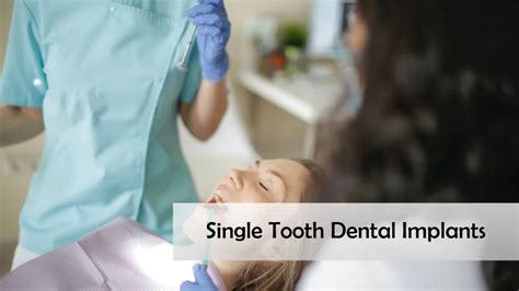 Single Tooth Dental Implants Dental Assets