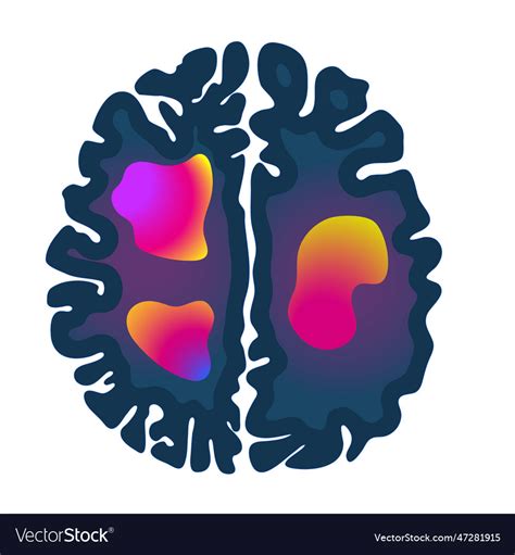 Mri Brain Scan Image Icon For Medical Diagnostics Vector Image