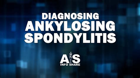 Diagnosing Ankylosing Spondylitis Youtube