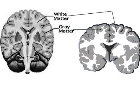 Enhanced White Matter Microstructure In Tai Chi Practitioners To Reduce