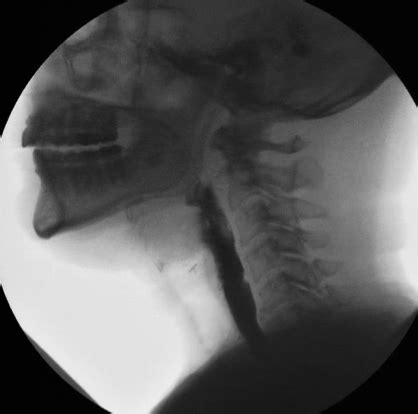 DX MedII Exam 1 Radiology Flashcards Quizlet