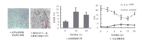 一严重烧伤早期即可出现心肌损害 再生医学