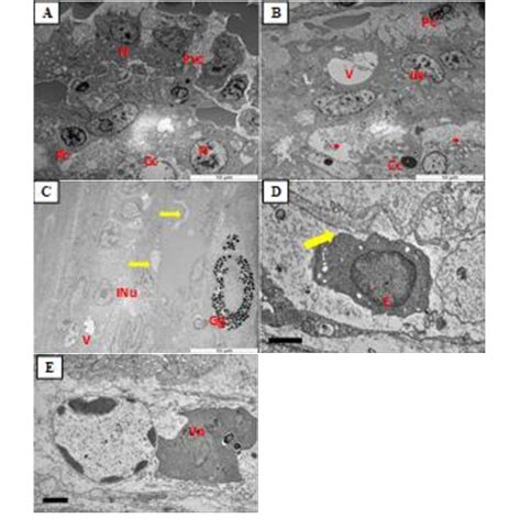 Transmission Electron Microscope Of Epithelial Cells Of C Gariepinus