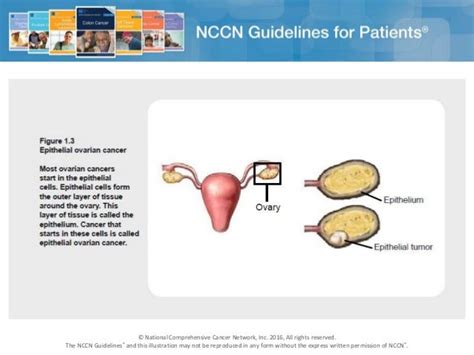 Nccn Guidelines For Patients Ovarian Cancer