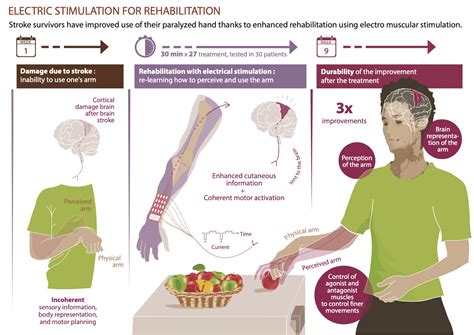 Sensory Motor Symptoms At Robin Lewis Blog