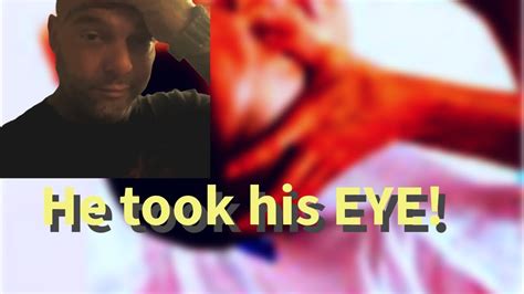 Eye Gouged Out By Inmate What I Saw Youtube