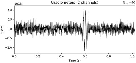 Time Frequency On Simulated Data Multitaper Vs Morlet Vs Stockwell