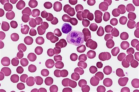 Blood Smear Light Micrograph Bild Kaufen 13504436 Science Photo