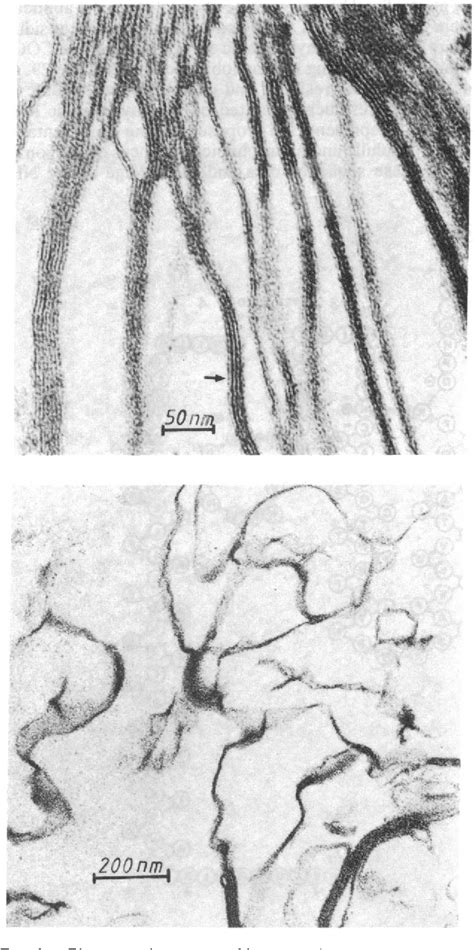 Figure 1 From Structure And Molecular Arrangement Of Proteolipid