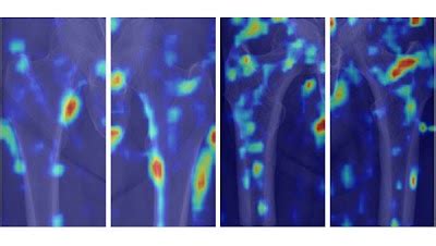 Radiology Artificial Intelligence On Twitter SNU Rad Developed And