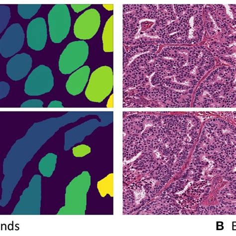 histopathological slices of a colon and b breast tissues and their