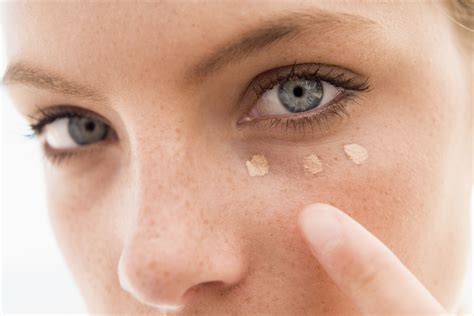 Treating And Preventing Facial Spider Veins