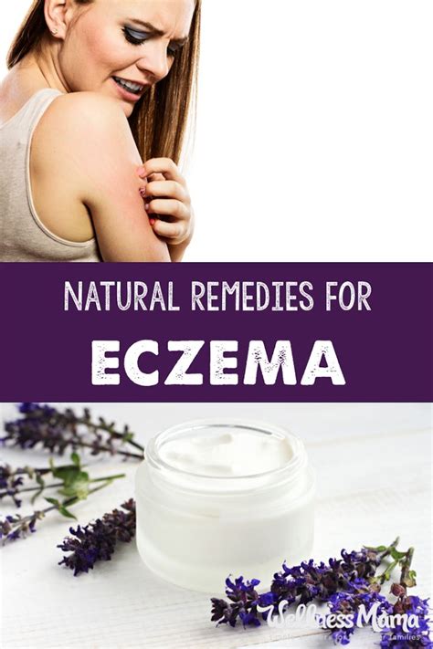 7 Natural Remedies For Eczema Eczema Remedies Natural Remedies For