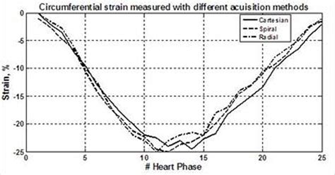 Assessment Of Myocardial Strain Using Strain Encoding Senc Mri