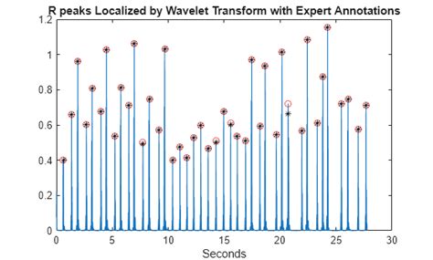 R Wave Detection In The Ecg Matlab And Simulink