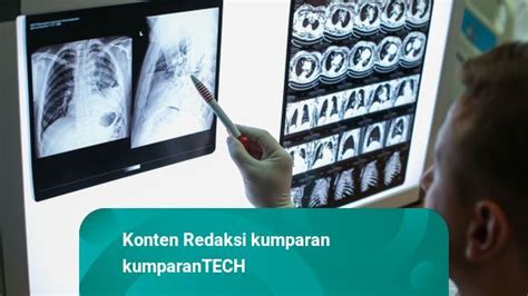 Google Dan Perusahaan Teknologi Medis Bikin AI Pendeteksi Kanker Kumparan