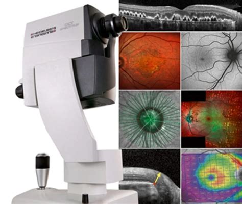 Optomap And Oct Retinal Exam Belfast And Northern Ireland Rosemary Mcwatters Opticians