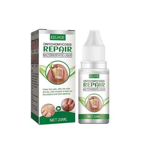 Essential Oil Nail Fungus Repair Liquid Nail Thickening Discoloration