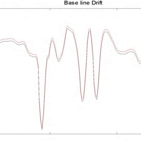 Eeg Signal After Removal Of Baseline Drift Ma Mean And Standard
