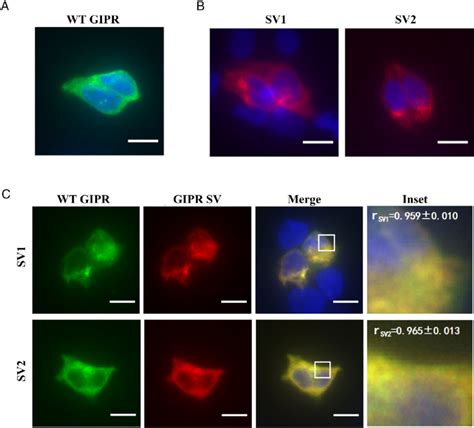 Colocalization Of Gipr And Its Svs Immunofluorescence Staining Of