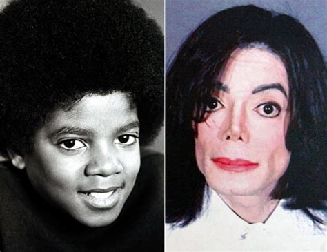 Before And After Plastic Surgery Michael Jackson