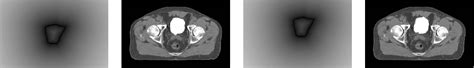 Figure 1 From Interactive Graph Cut Based Segmentation With Shape