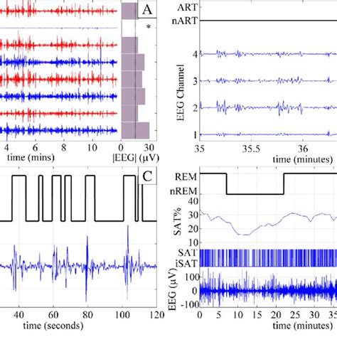 The Pre Processing Stages Used To Segment The 8 Channel EEG Recording Download Scientific