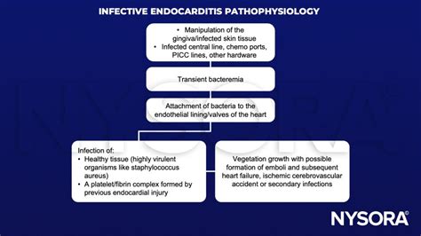 Infective Endocarditis Prophylaxis Nysora
