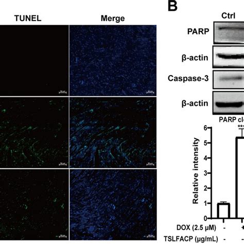 Tslfacp Alleviates Dox Induced Myocardial Injury By Reducing Apoptosis