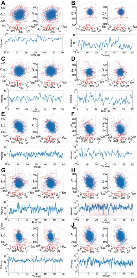 Different Brain Functions Have Cortical States Emerging From Fecat Download Scientific Diagram