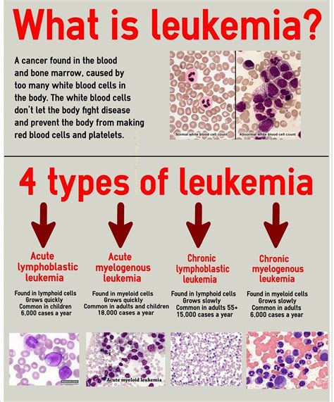 Pin On Diseases