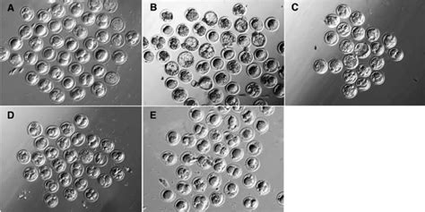 Requirement Of The Oocyte Nucleolus For The Early Step Of Pronucleus