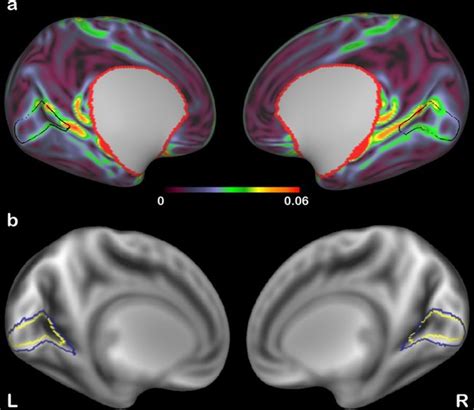 Figures And Data In Development Of Visual Cortex In Human Neonates Is Selectively Modified By