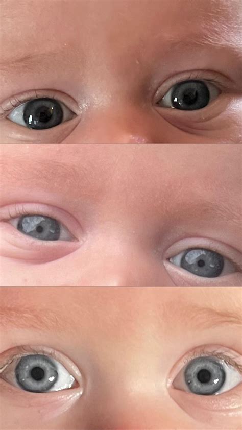 Bebés Feos En El Mundo