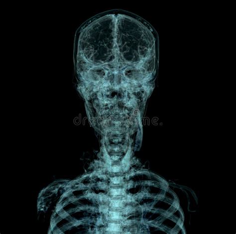 Human Skull Brain By Ct Scan X Ray Visualization Inside Of Skull