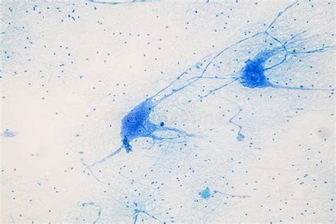 Motor Neuron Under The Microscope Stock Image Image Of Dendrite