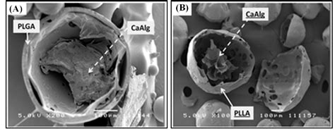 Figure 1 From Plga Core Shell Nano Microparticle Delivery System For