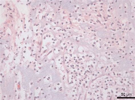 Section Of The Left Optic Nerve Hematoxylin And Eosin Staining Reveals