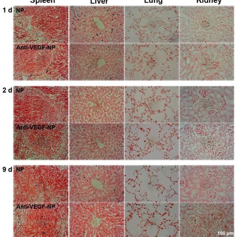 Anti Vegf Nps Or Nps Are Present In The Spleen And Liver But Not The