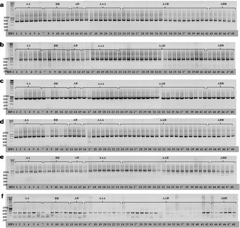 Pcr Analysis For The Detection Of Retrotransposon Reverse Transcriptase Download Scientific