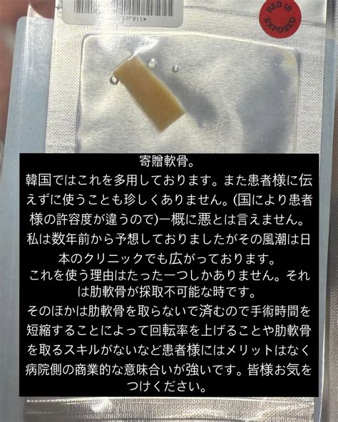 Dr 鉄 鼻整形専門 術後1ヶ月 肋軟骨よる鼻中隔延長、耳介軟骨移植、鼻尖形成、貴族手術、猫手術、筋膜移植 脂肪注入 額、こめかみ、頬